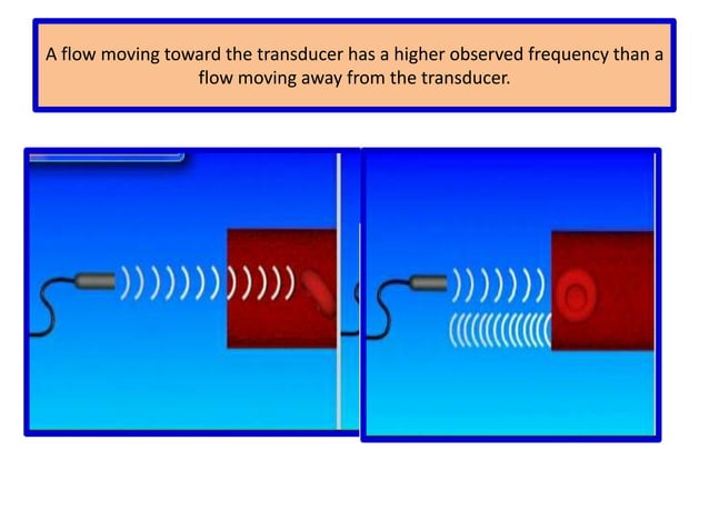 Basics of echo & principles of doppler echocardiography | PPTX | Heart ...
