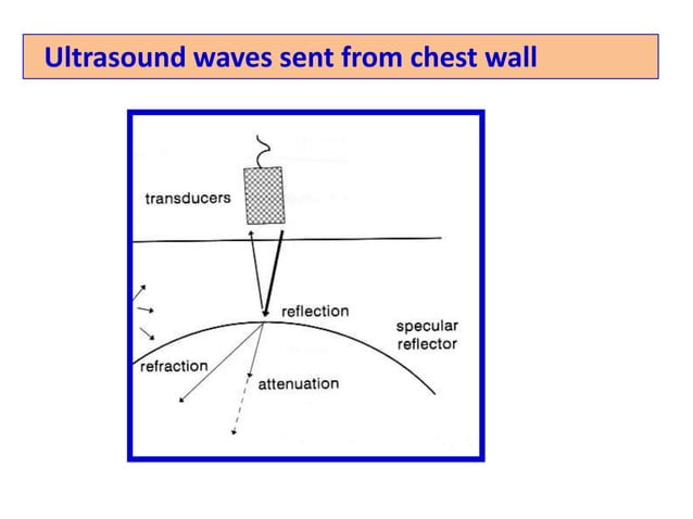Basics of echo & principles of doppler echocardiography | PPTX | Heart ...