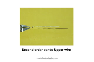 Basics of edge wise /certified fixed orthodontic courses by Indian ...