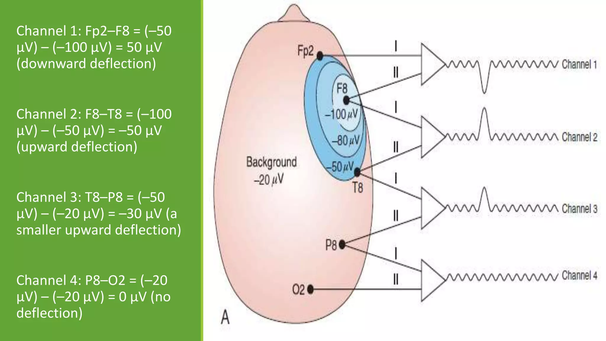 Basics of electroencephalography | PPTX