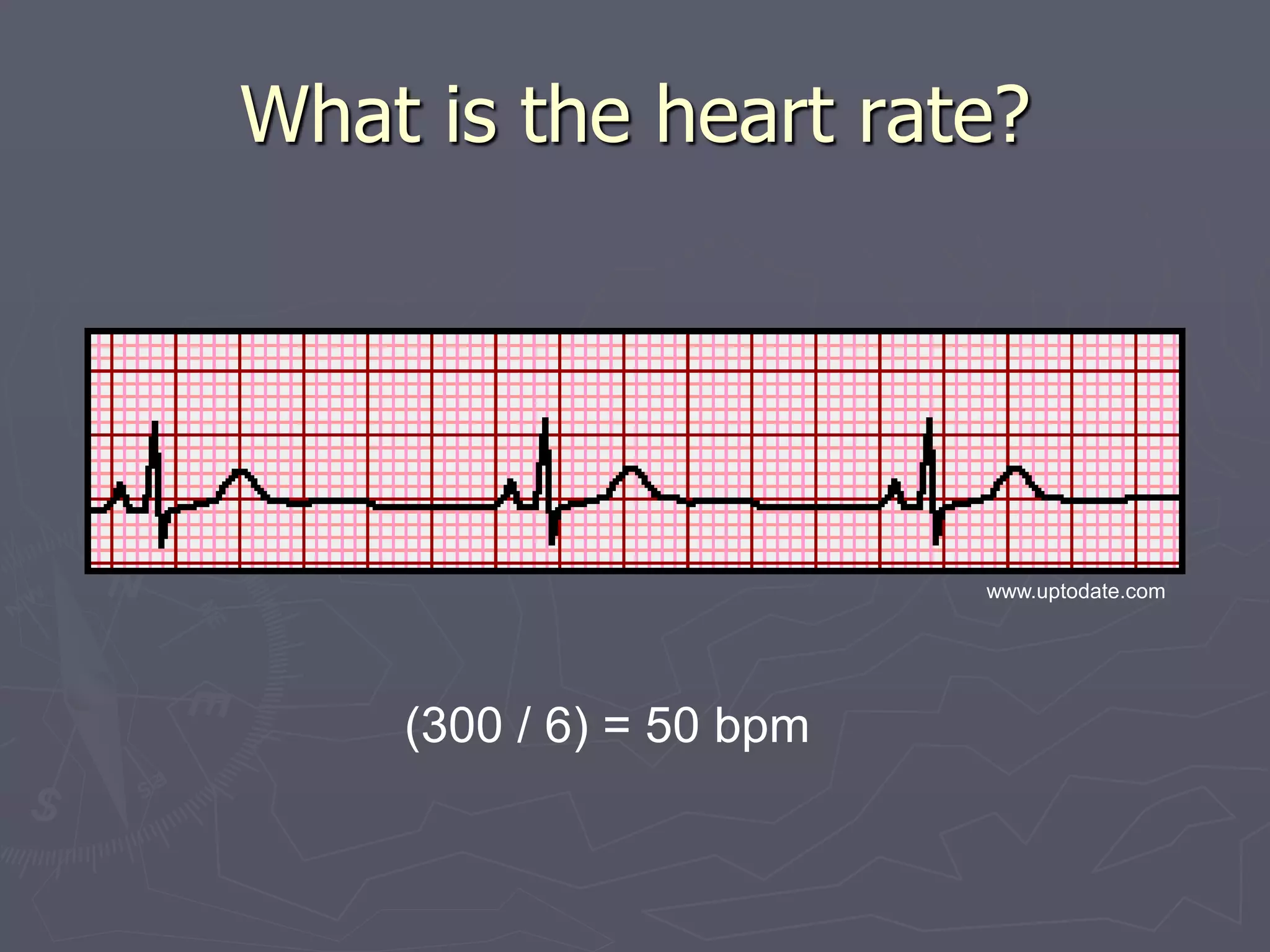 Basics of EKG Interpretation.ppt