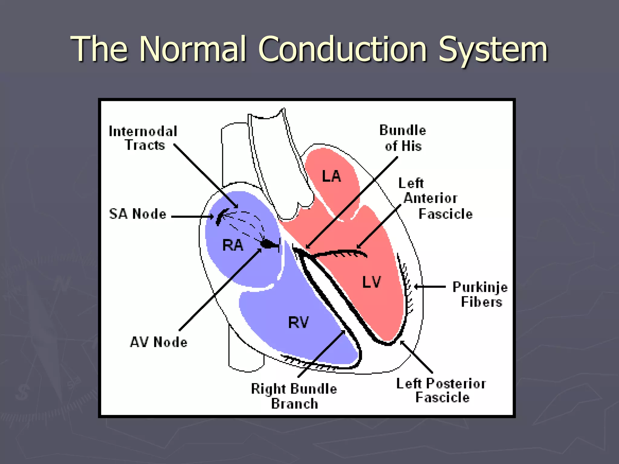 Basics of EKG Interpretation.ppt
