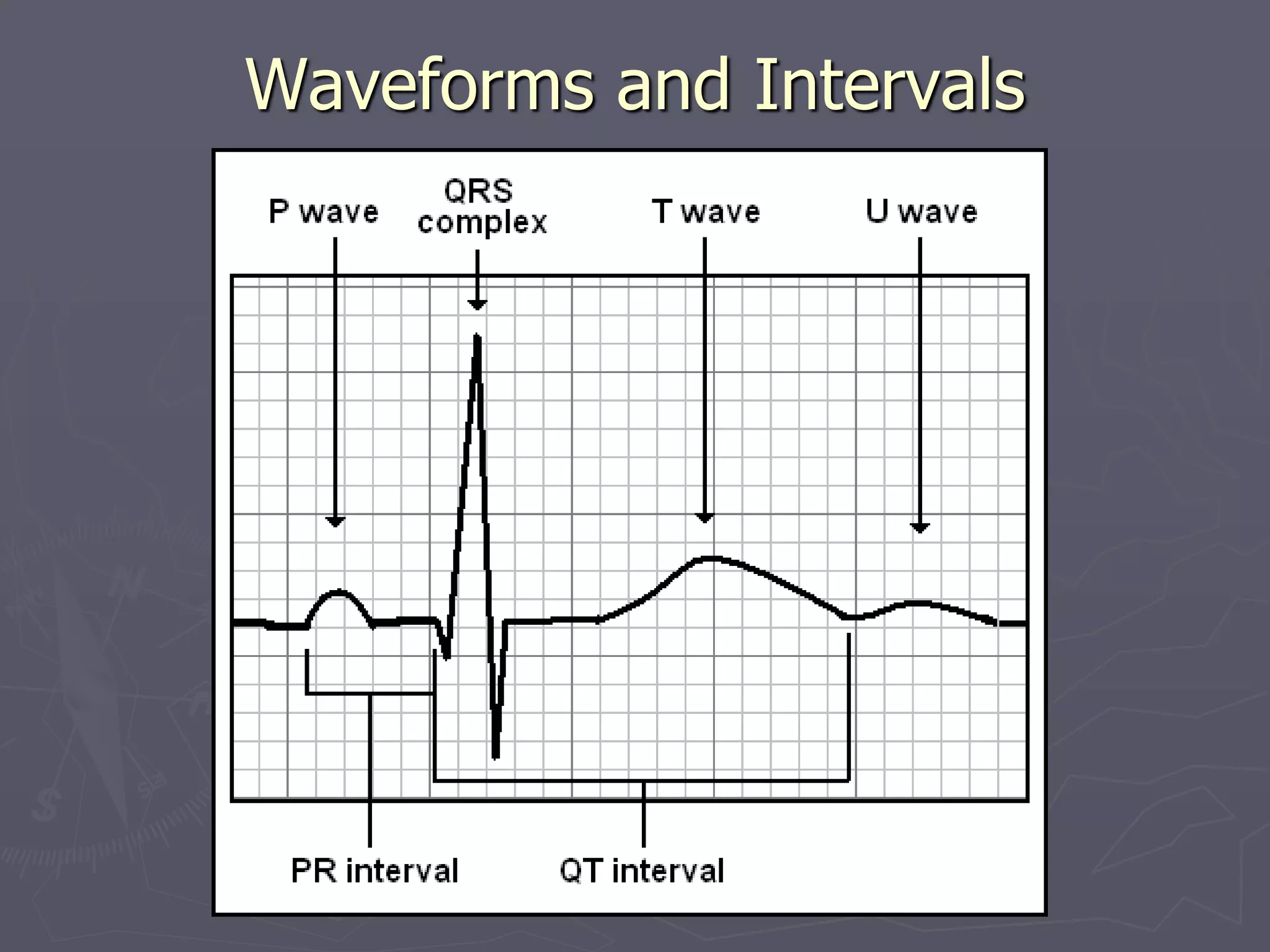 Basics of EKG Interpretation.ppt