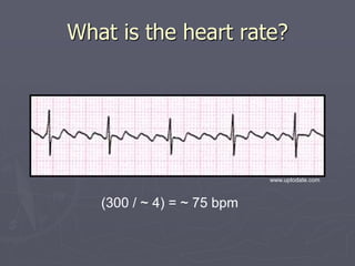 Basics of EKG Interpretation.ppt