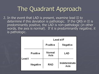 Basics of EKG Interpretation.ppt