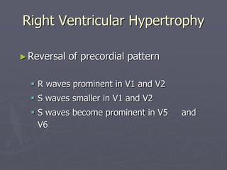 Basics of EKG Interpretation.ppt