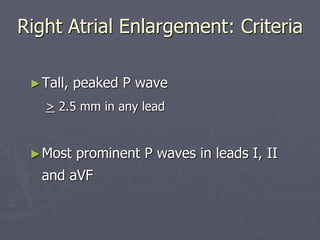 Basics of EKG Interpretation.ppt