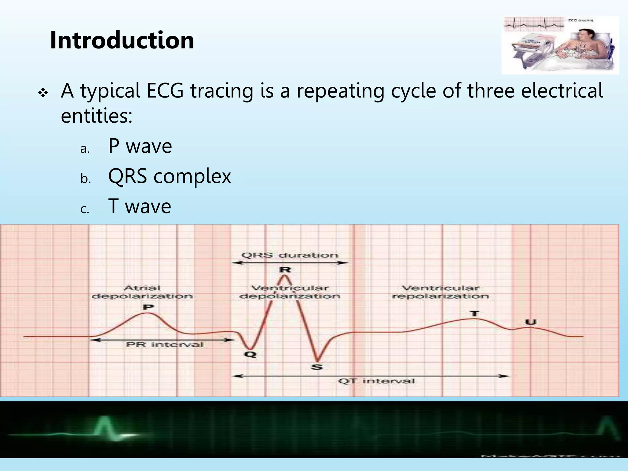 Basics of Electrocardiography.pptx