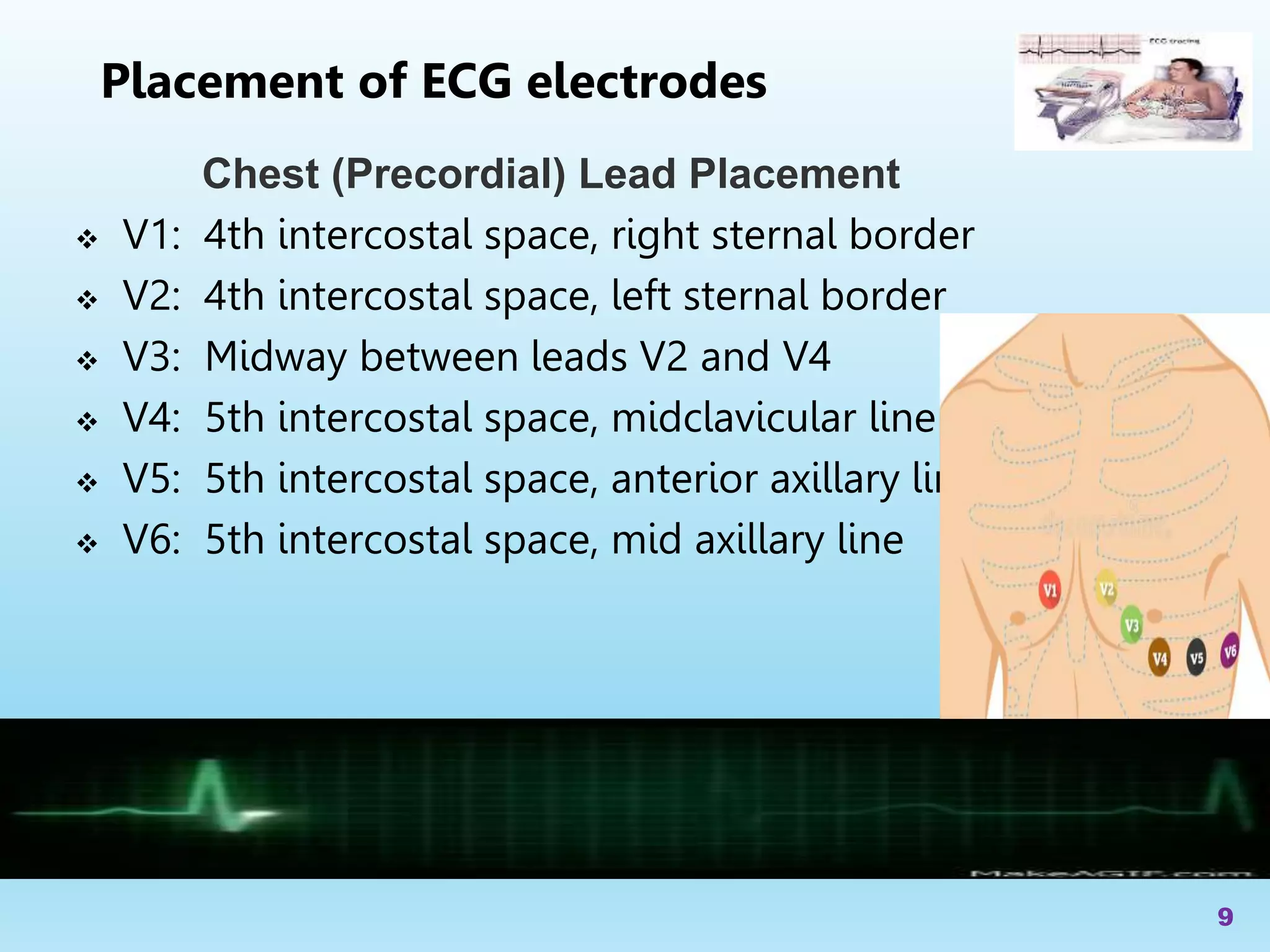Basics of Electrocardiography.pptx