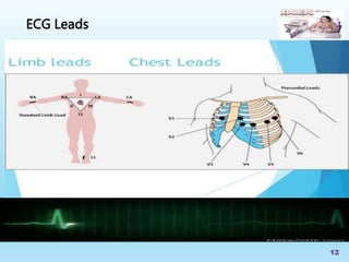 Basics of Electrocardiography.pptx