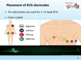 12 Lead Ecg Placement Color Coded