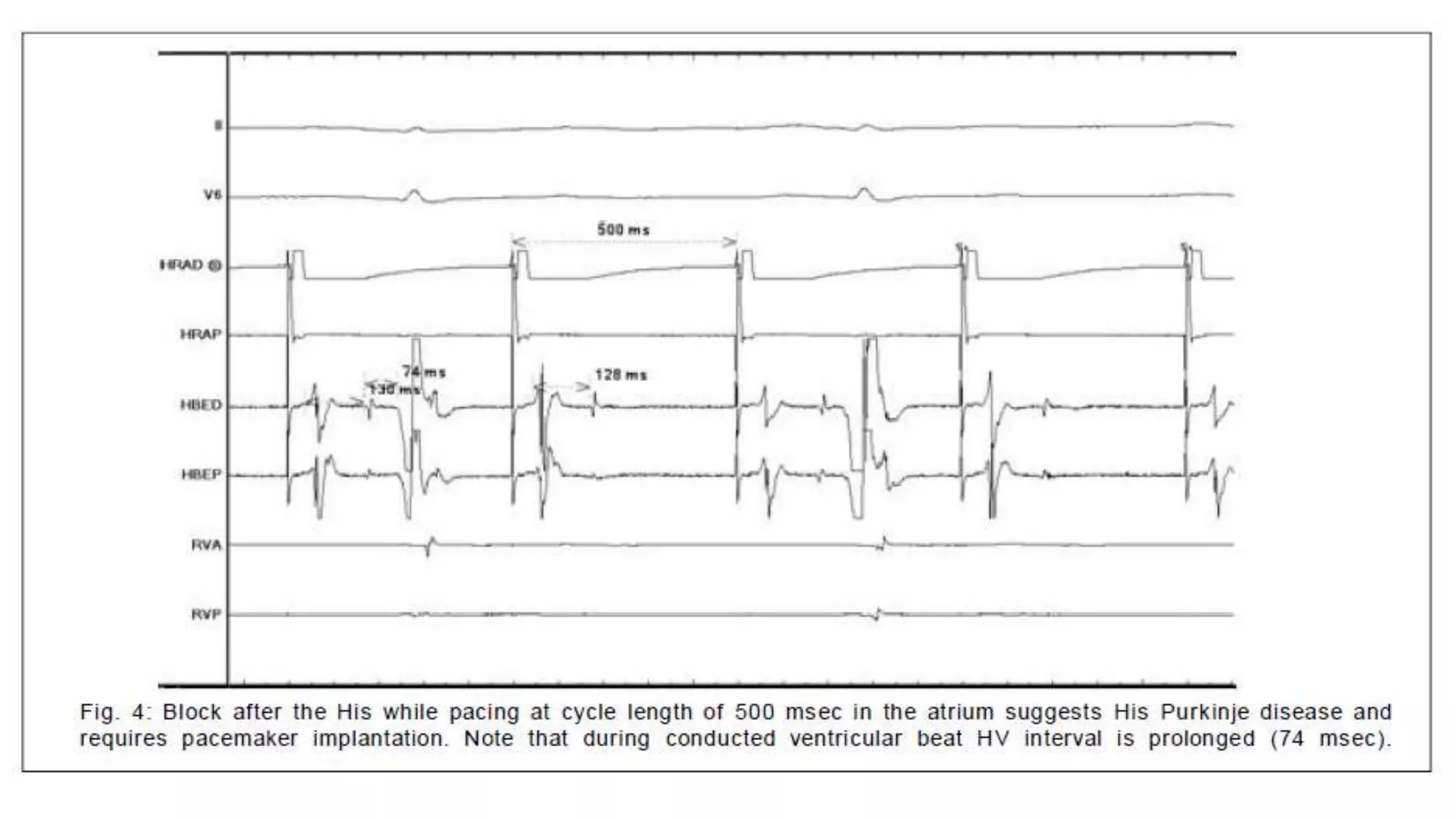 Basics of electrophysiology | PPTX