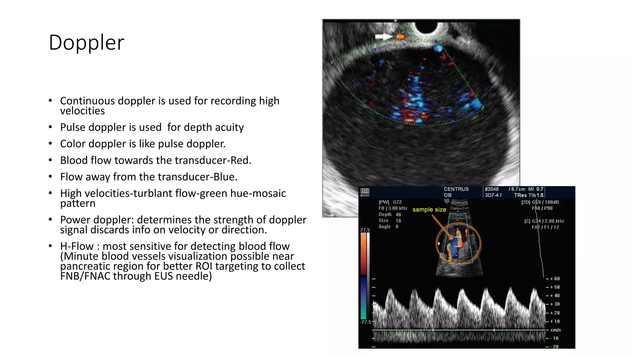 BASICS OF EUS PHYSICS.pptx