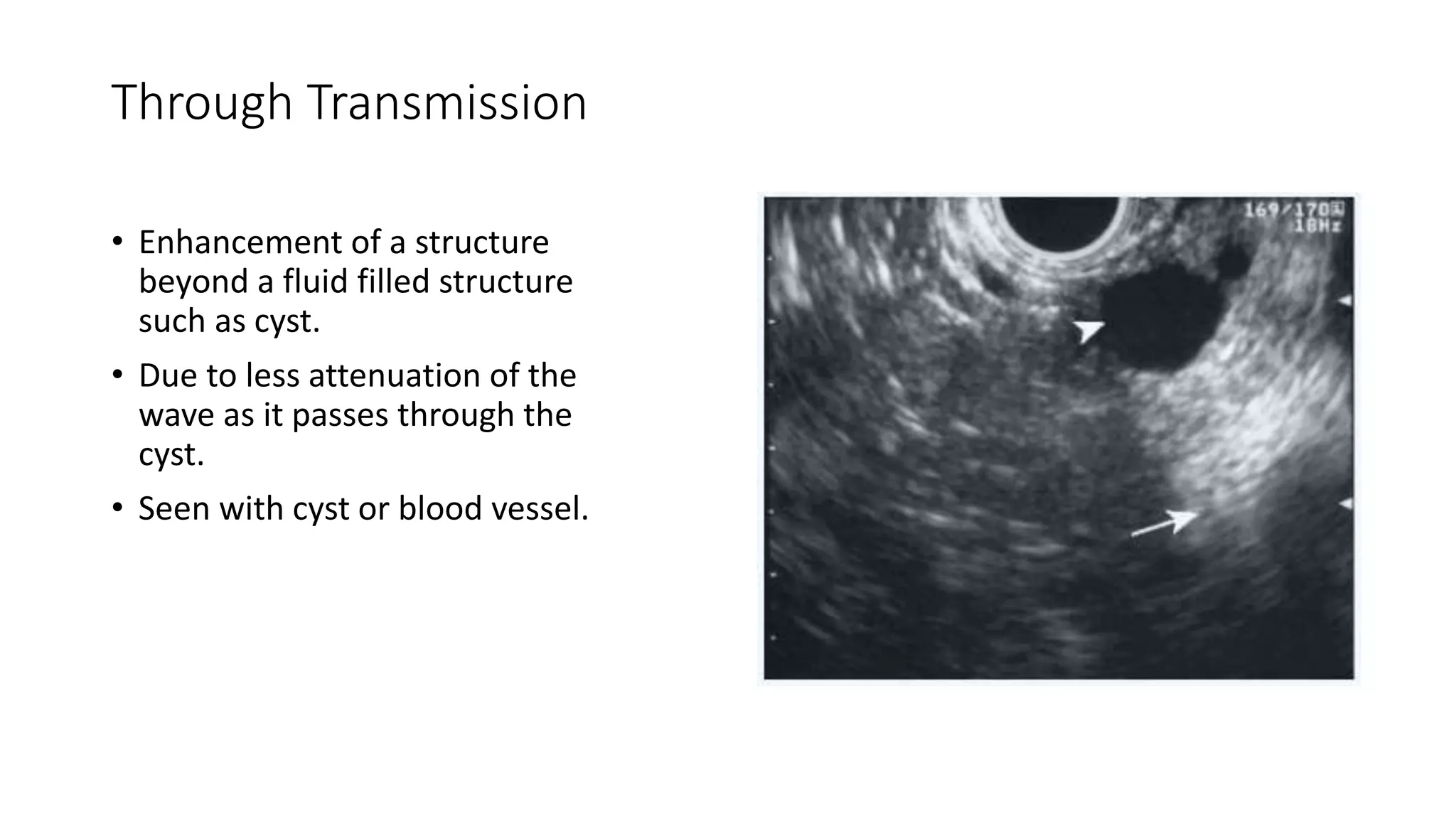 BASICS OF EUS PHYSICS.pptx