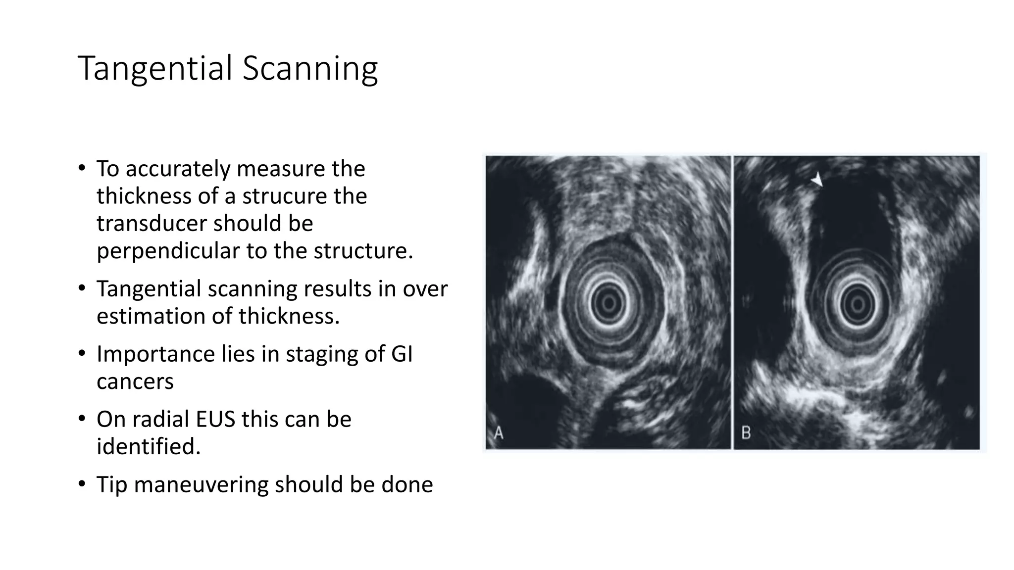 BASICS OF EUS PHYSICS.pptx
