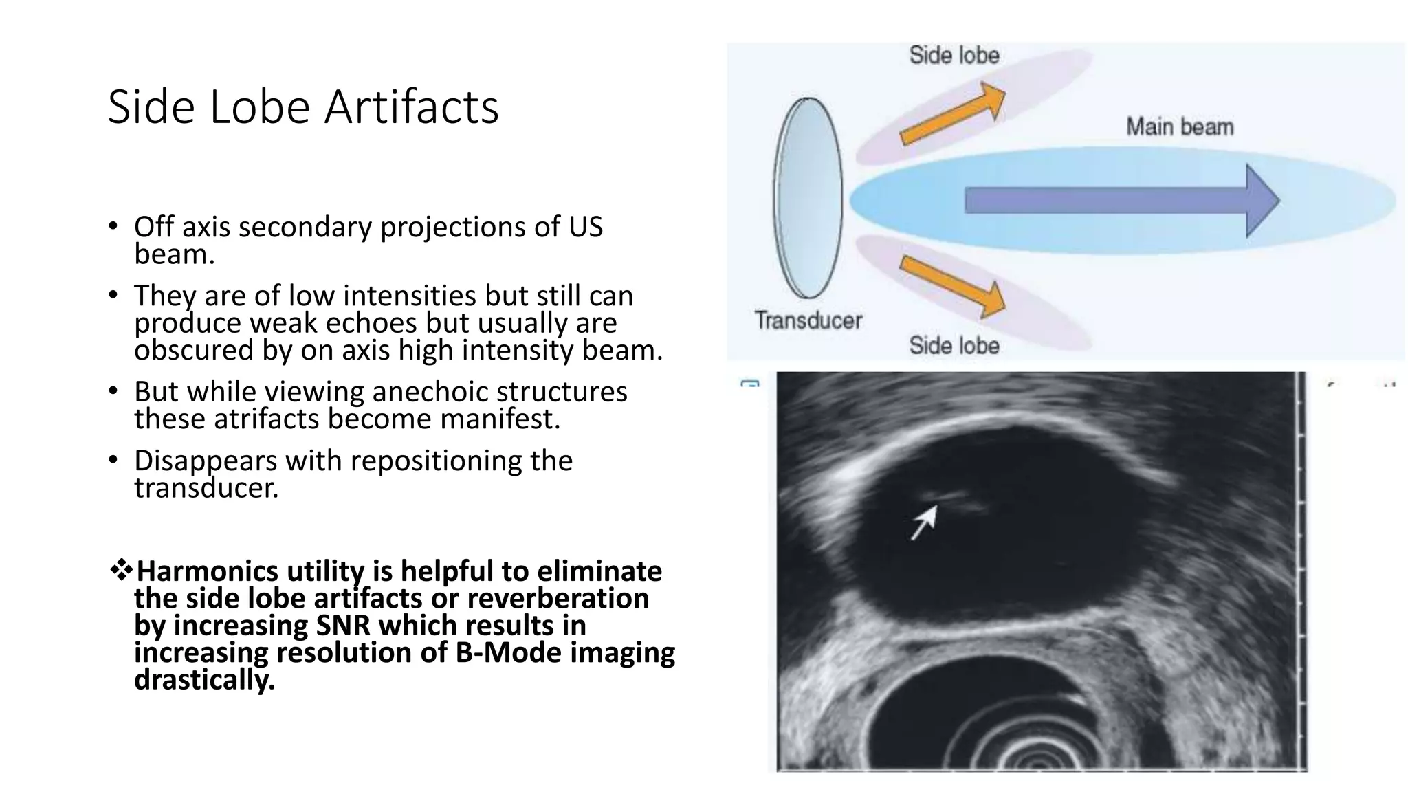 BASICS OF EUS PHYSICS.pptx