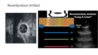 BASICS OF EUS PHYSICS.pptx