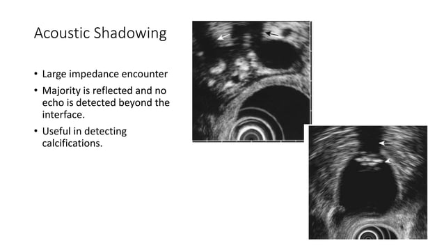 BASICS OF EUS PHYSICS.pptx | Physics | Science