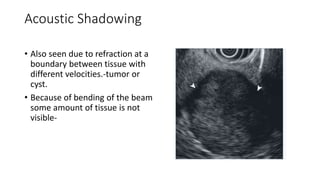 BASICS OF EUS PHYSICS.pptx
