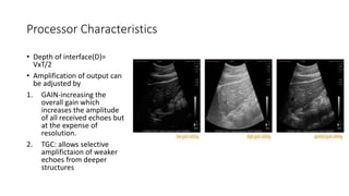 BASICS OF EUS PHYSICS.pptx