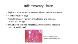 Basics of fracture healing of bones.pptx