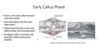 Basics of fracture healing of bones.pptx