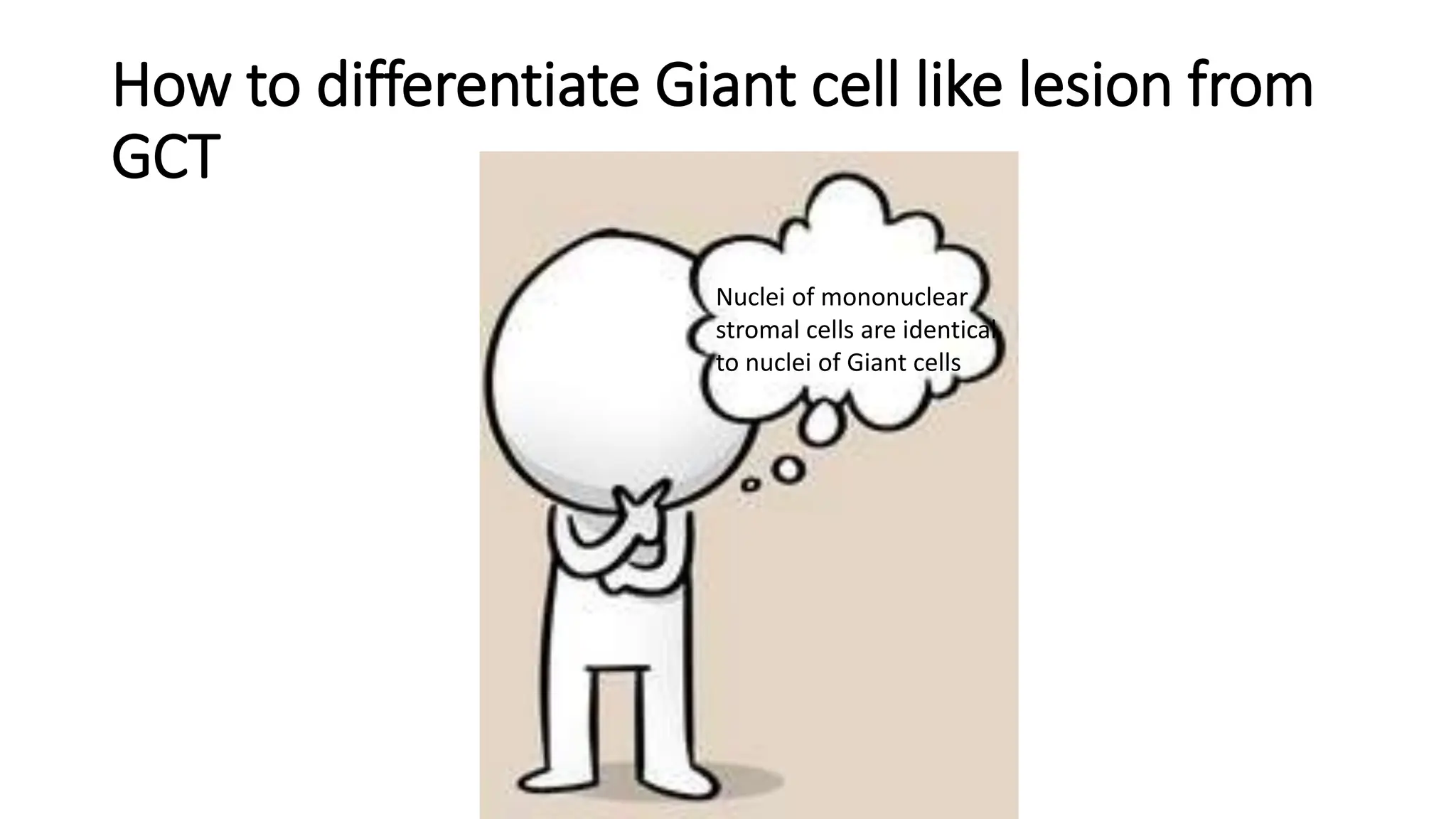 Basics of Giant Cell Tumor of bone (GCTB) | PPTX