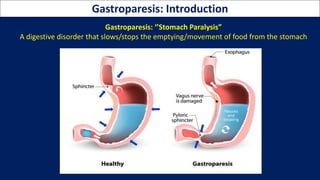 Basics of GERD, peptic Ulcer & Gastroparesis | PPT