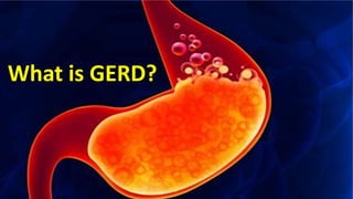 Basics of GERD, peptic Ulcer & Gastroparesis | PPT