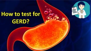 Basics of GERD, peptic Ulcer & Gastroparesis | PPT