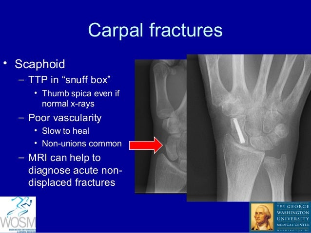 Basics of Hand Surgery