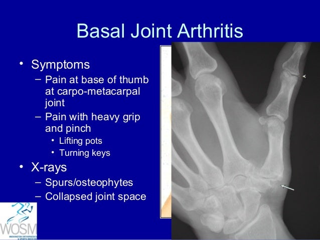 Basics of Hand Surgery