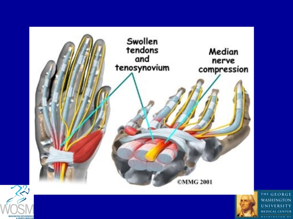 Basics of Hand Surgery