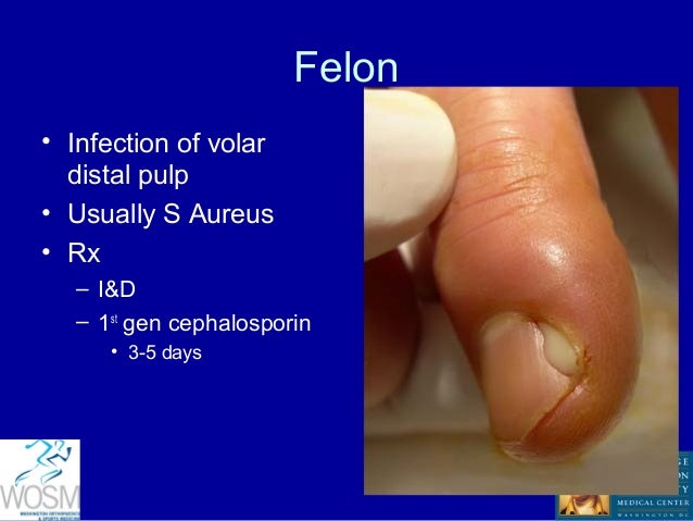 Basics of Hand Surgery