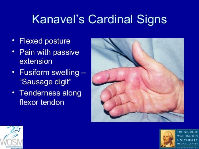 Basics of Hand Surgery