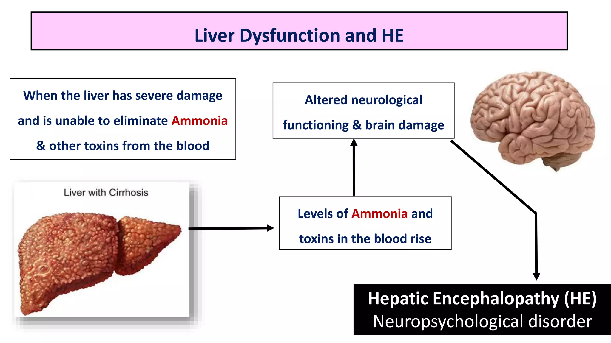 Basics of Hepatic Encephalopathy | PPTX | Brain and Nervous System ...