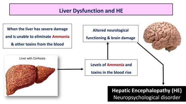 Basics of Hepatic Encephalopathy | PPTX | Brain and Nervous System ...