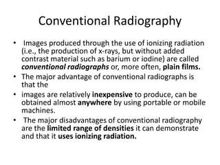 Basics of imaging by mohamed abou el ghar | PPT