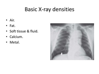 Basics of imaging by mohamed abou el ghar | PPT
