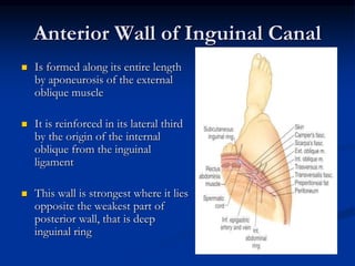 Basics of inguinal hernias | PPT
