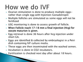 Basics of IVF for GP | PPT