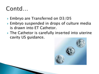 Basics of IVF for GP | PPT