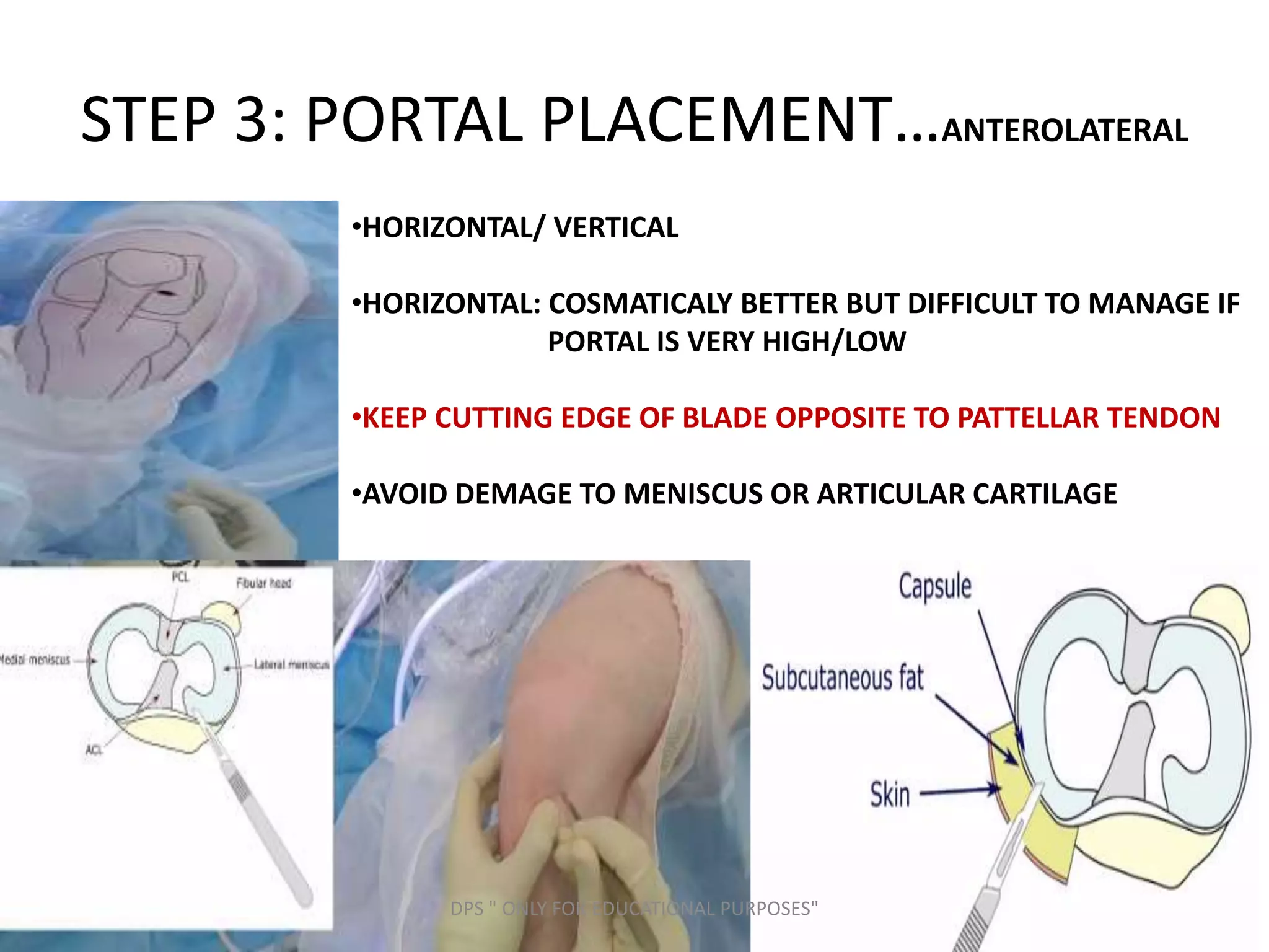 Basics of knee arthroscopy by dr. d. p. swami | PPTX