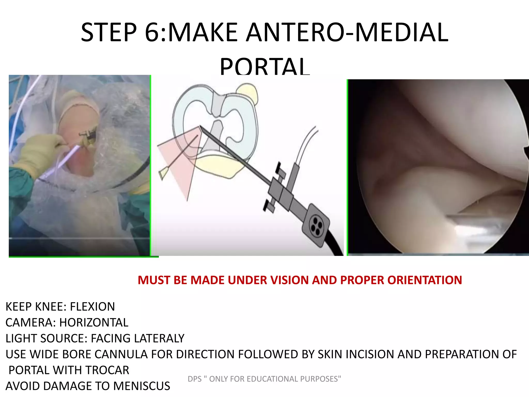 Basics of knee arthroscopy by dr. d. p. swami | PPTX