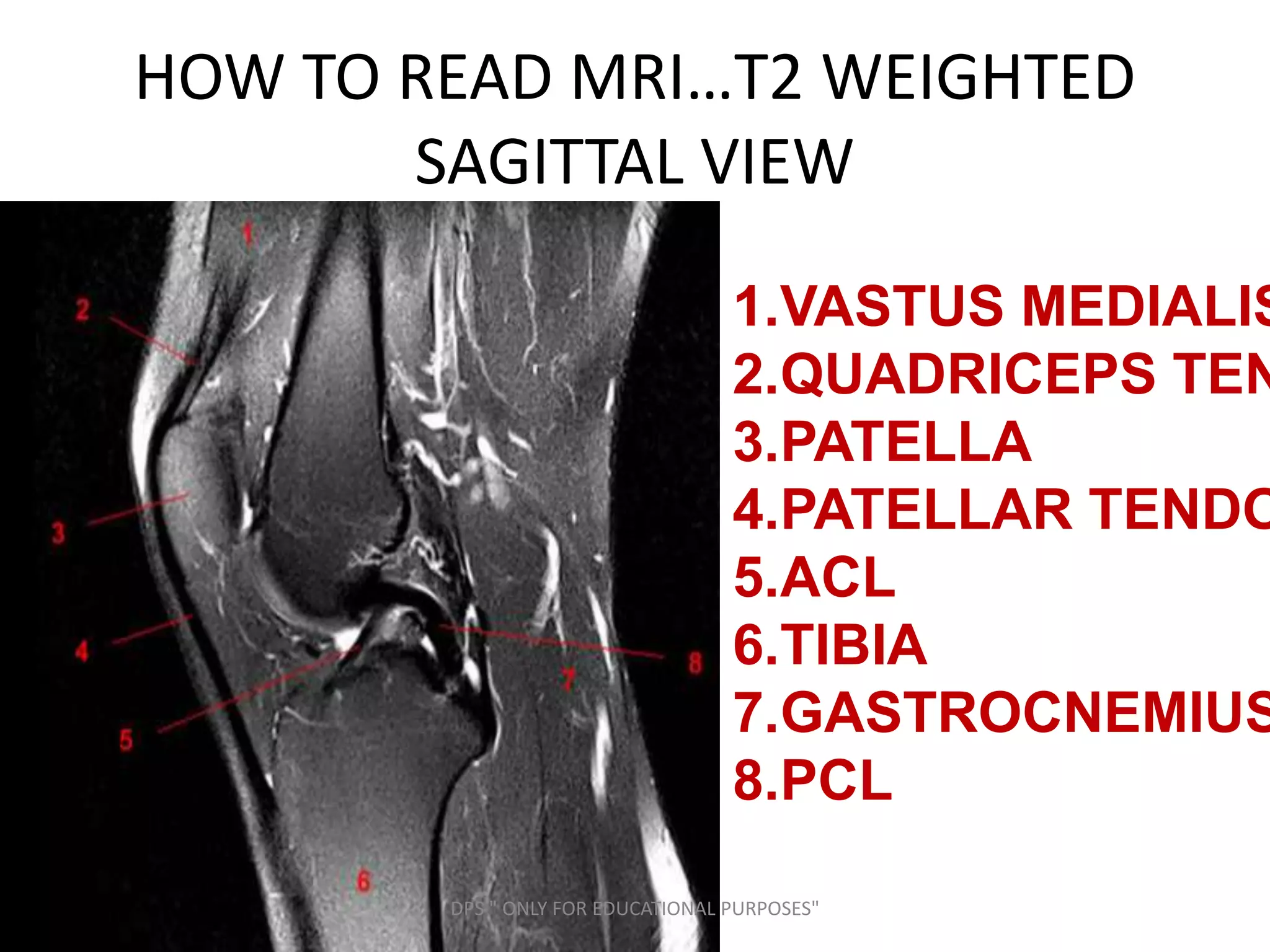 Basics of knee arthroscopy by dr. d. p. swami | PPTX