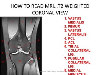 Basics of knee arthroscopy by dr. d. p. swami | PPTX