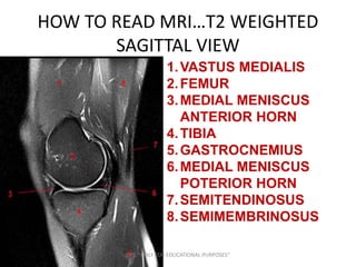 Basics of knee arthroscopy by dr. d. p. swami | PPTX