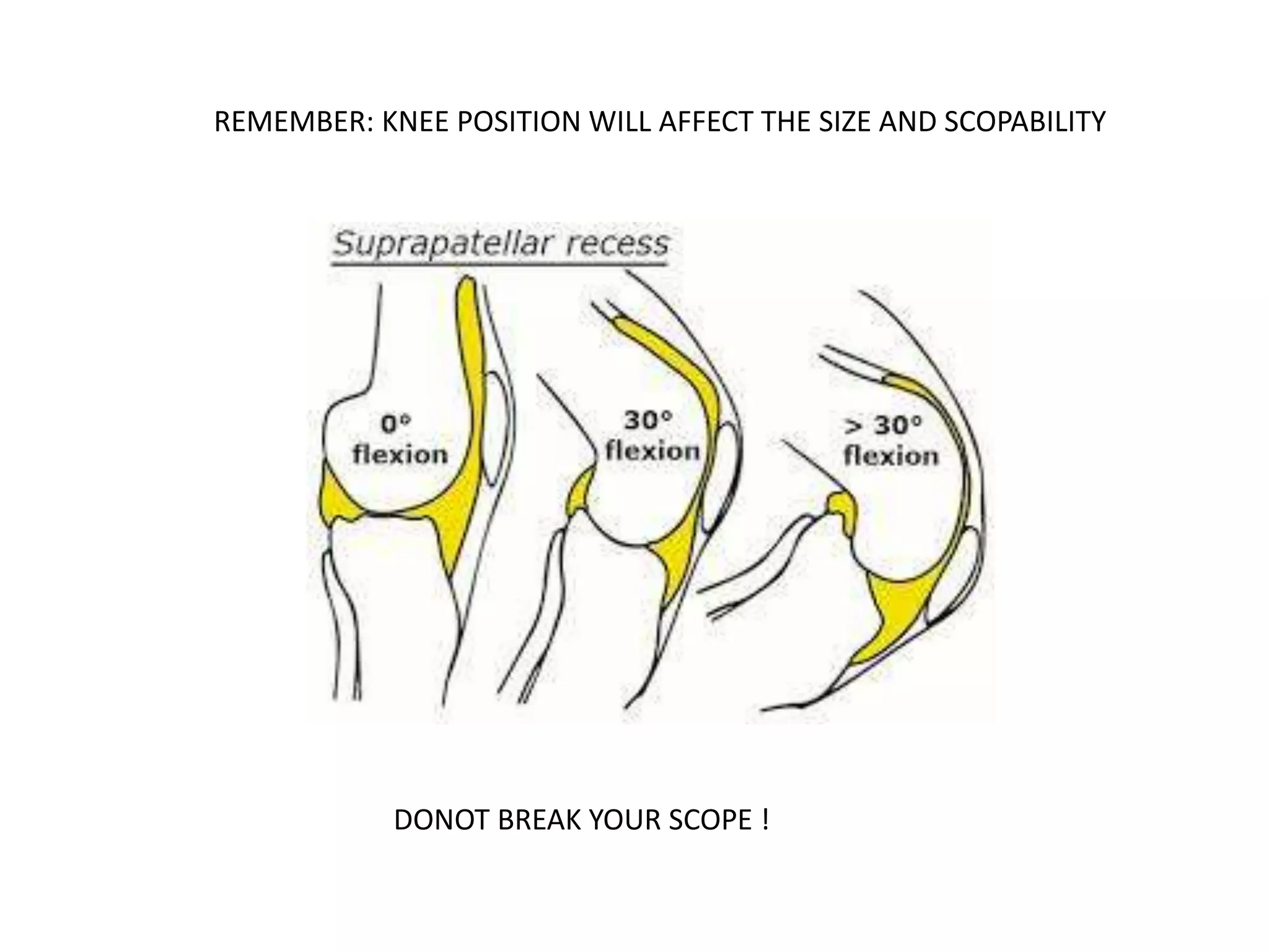 Basics of knee arthroscopy for the beginners | PPTX