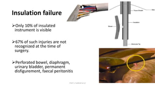 Basics of laparoscopy.pptx