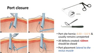 Basics of laparoscopy.pptx